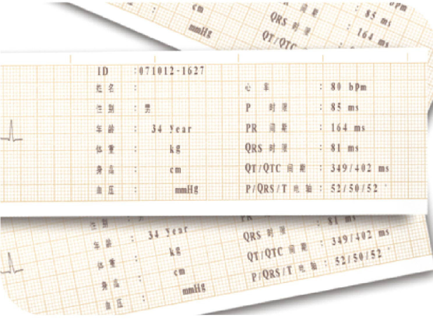 Code Medical System - Comen - ECG | CM100 Single Channel