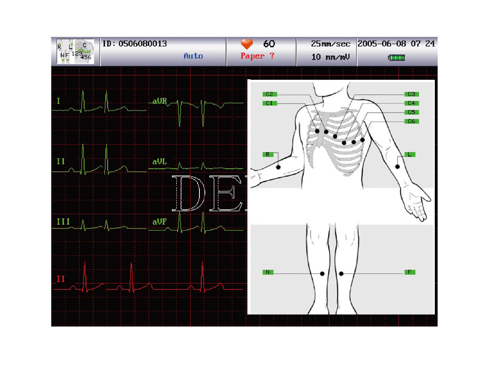 Code Medical System - Comen - ECG | CM600 Six Channel